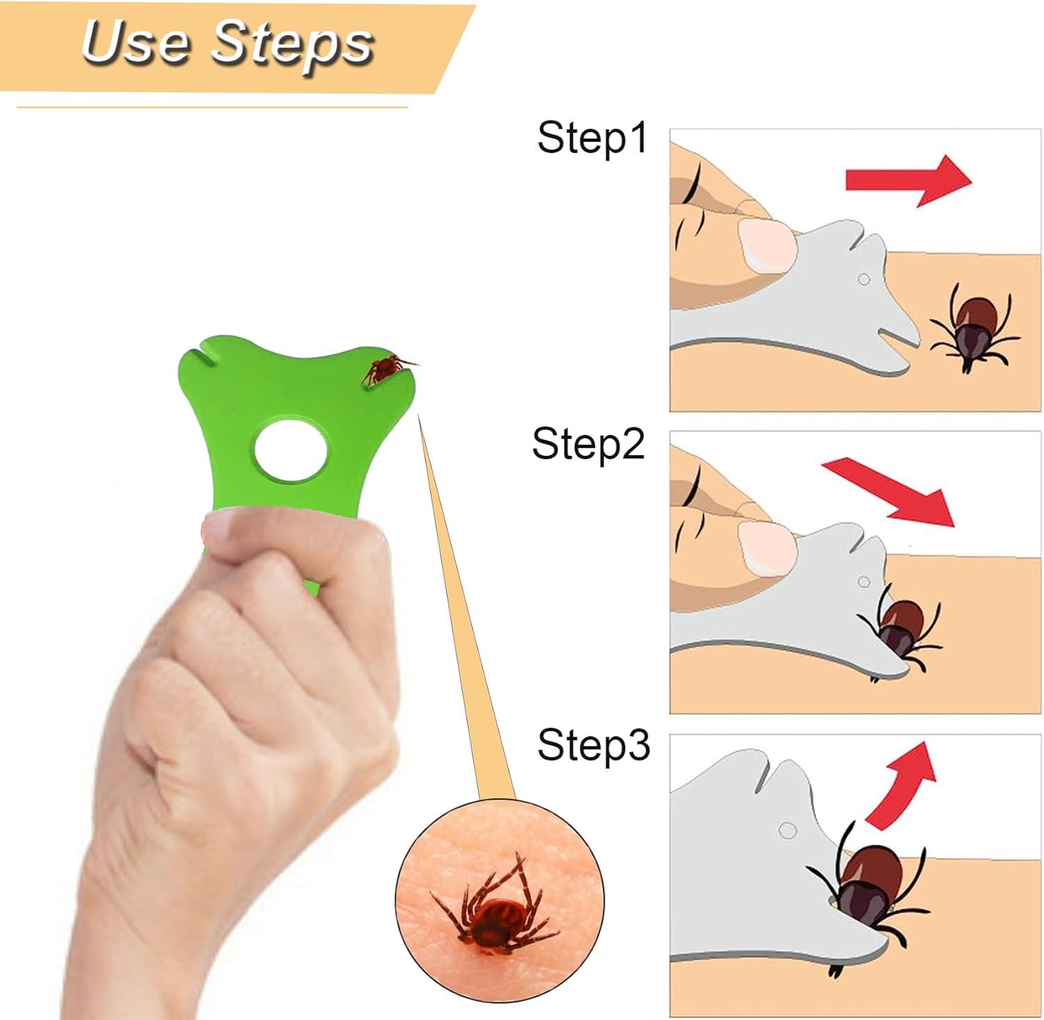 Jiechu Tick Card with Magnifying Glass - Efficient Tick Removal Tool ...