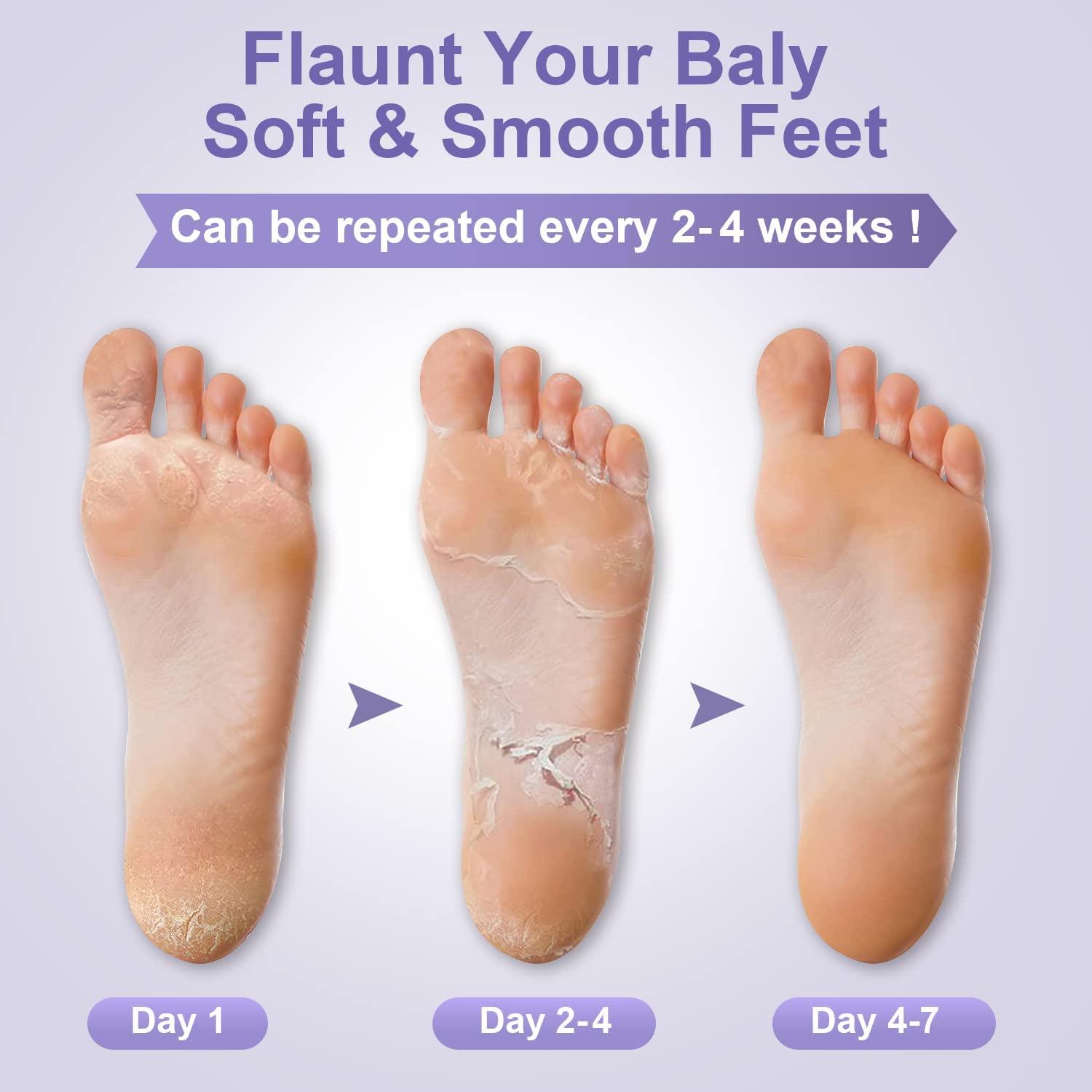 FUNNIR Foot Peel Mask Exfoliant for Peeling Off Calluses, Natural ...