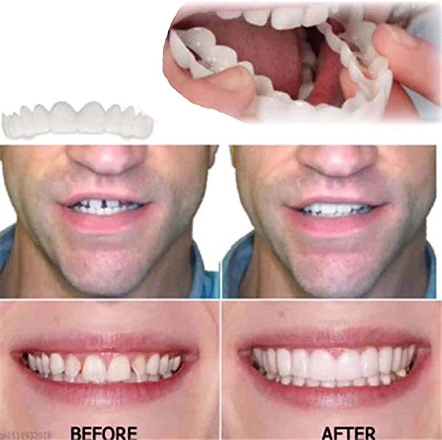 Asiacreate Temporary Dentures Kit - Customizable Smile Teeth Veneers ...