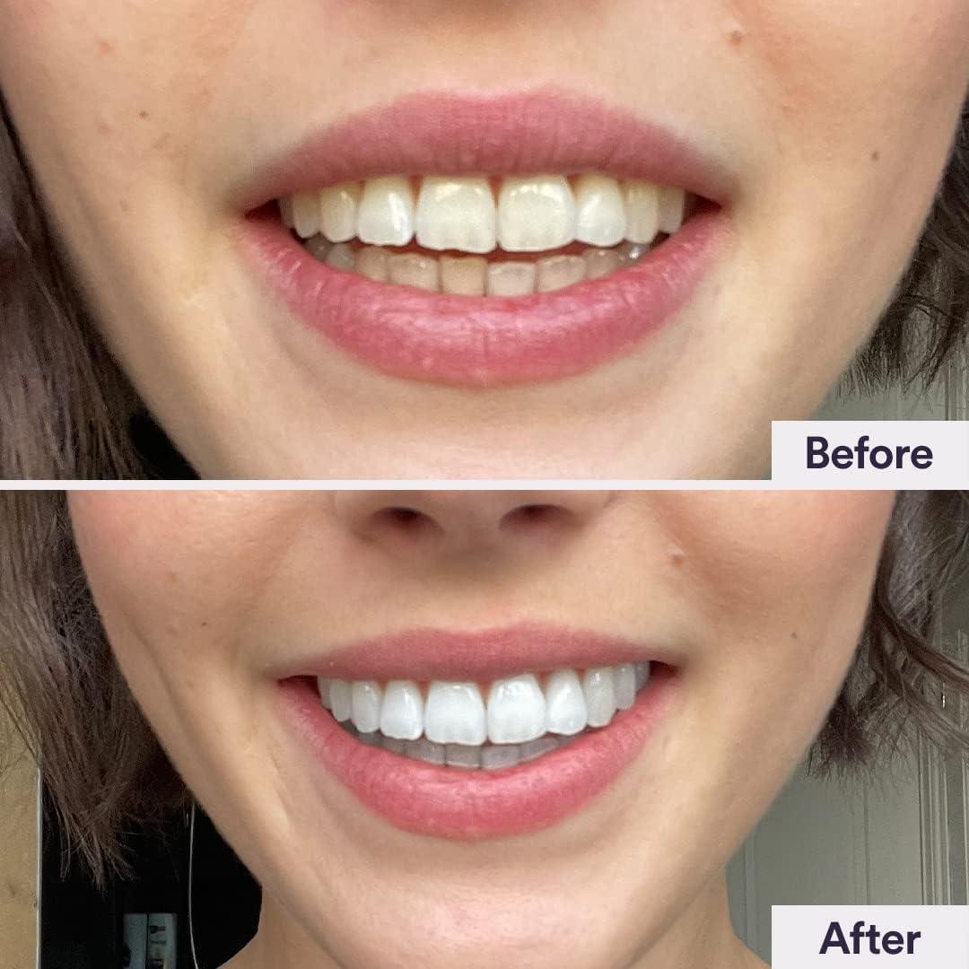 Smirk Teeth Brightening Powder 40g - Natural Whitening Formula | Shop ...