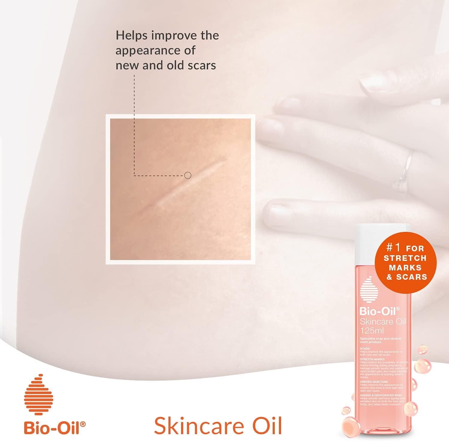 Bio-Oil Skincare Oil - Improve the Appearance of Scars Stretch Marks ...