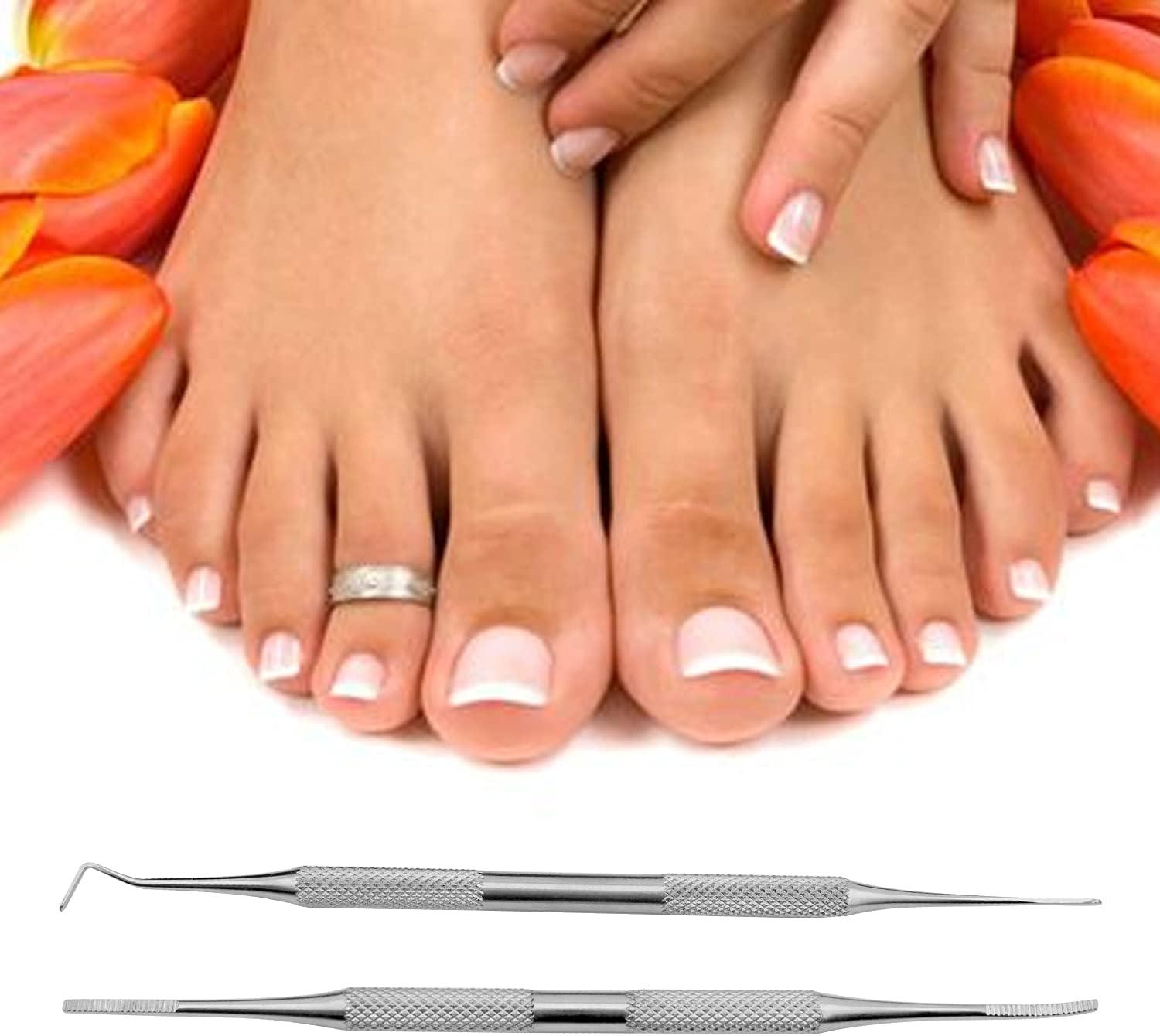 Haryali London Ingrown Toenail Treatment Kit - Double Ended Ingrown ...