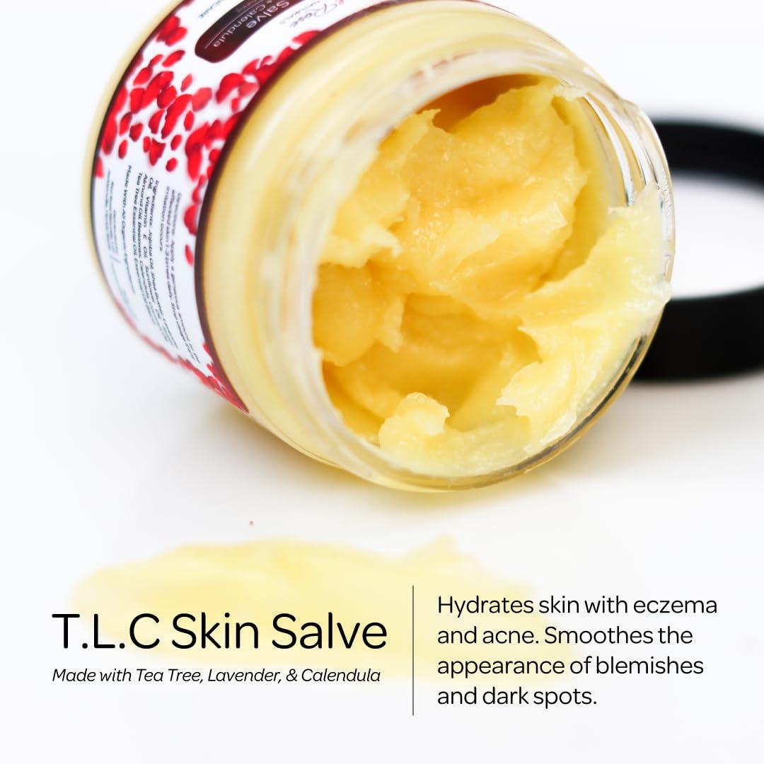 Red Rose Naturals TLC Skin Salve - 100% All Natural Balm for Eczema ...