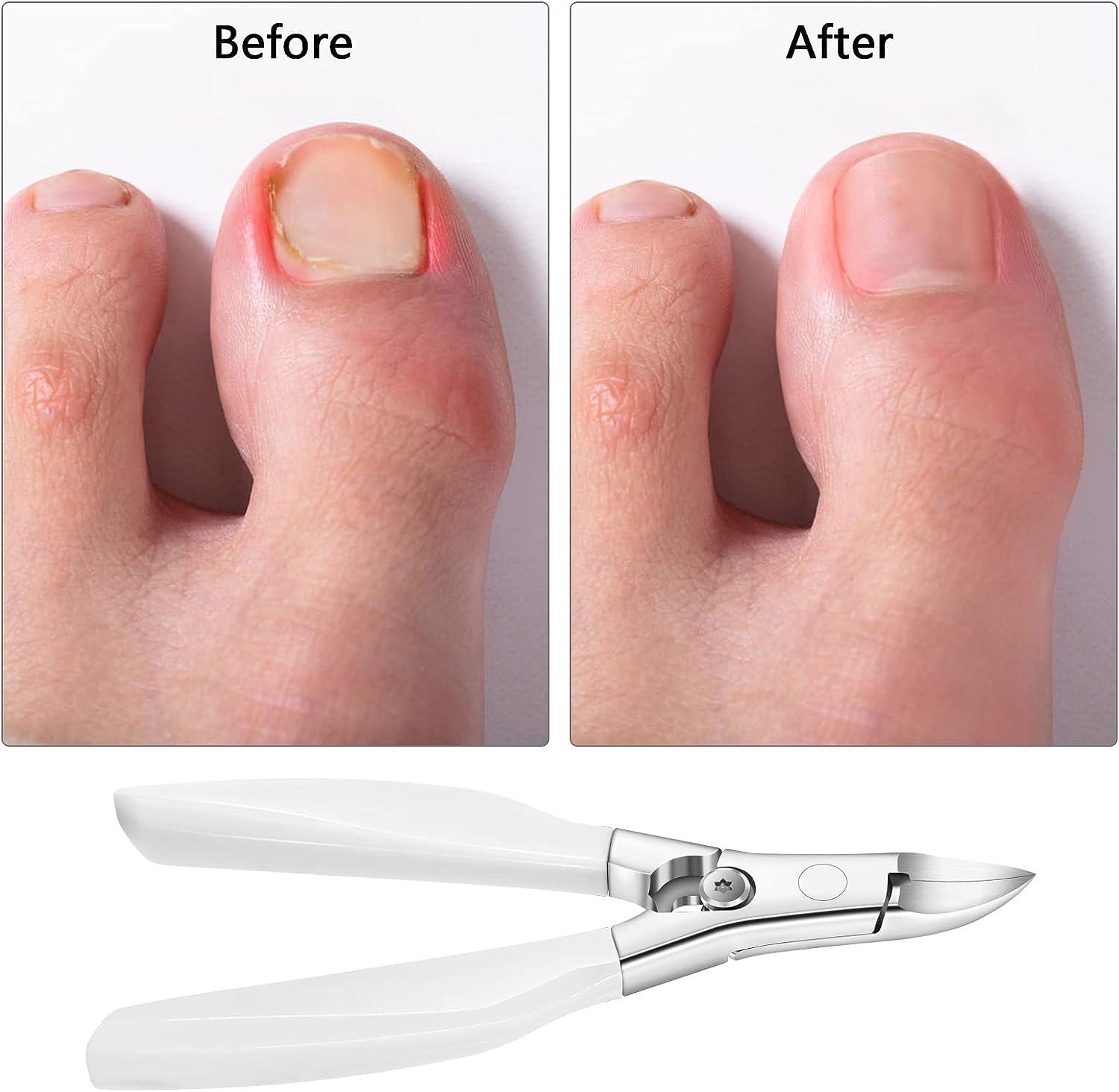 Professional Toe Nail Clipper for Ingrown and Thick Toenails ...