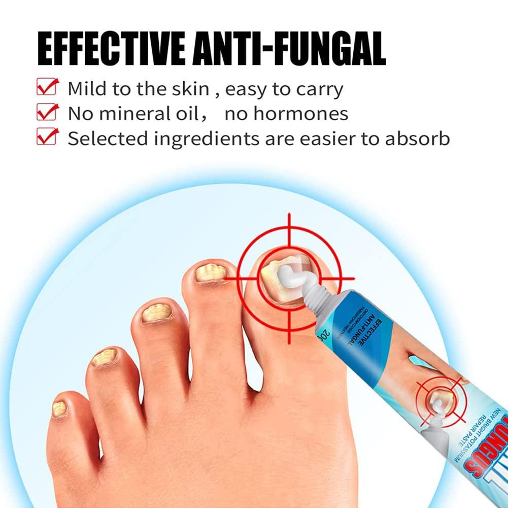 Best Nail Repair Cream for Fungus Treatment - Restores Discolored Nails - Toe & Finger Care ...