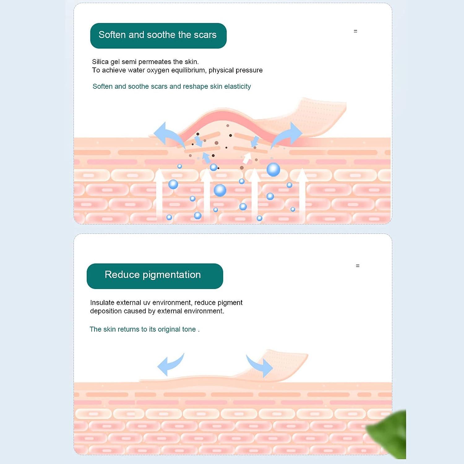 SILICONE SCAR SHEETS | Professional Gel Patch for Scar Removal, Stretch ...