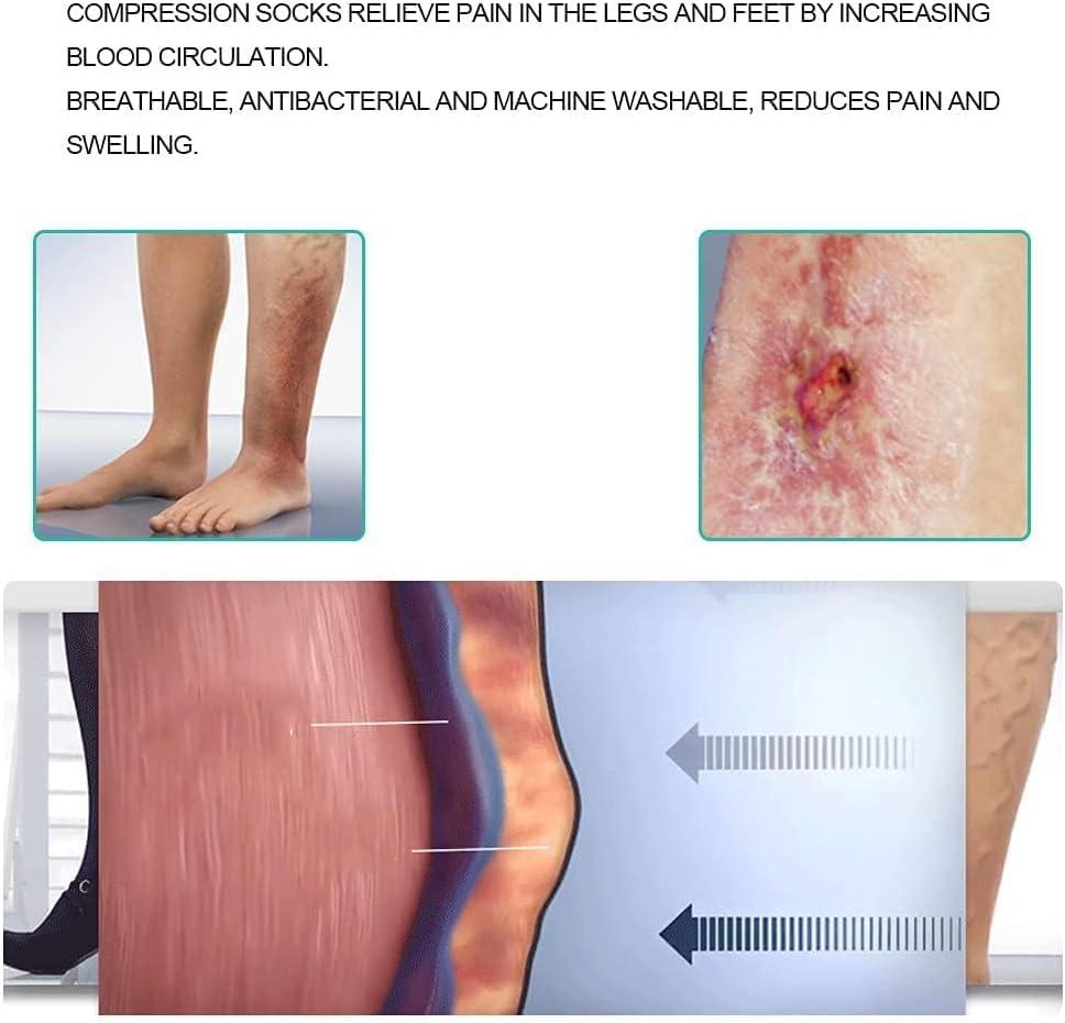 XXL Varicose Vein Socks & Calf Compression Sleeves - 20-32 mmHg Medical ...