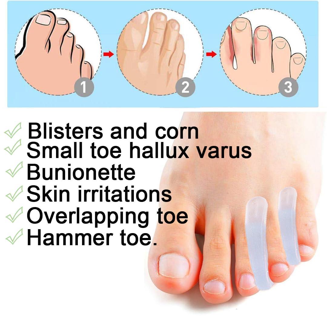 Mcvcoyh Flared Gel Pinky Toe Separators 10 Pieces Small Toe Spacers Toe ...