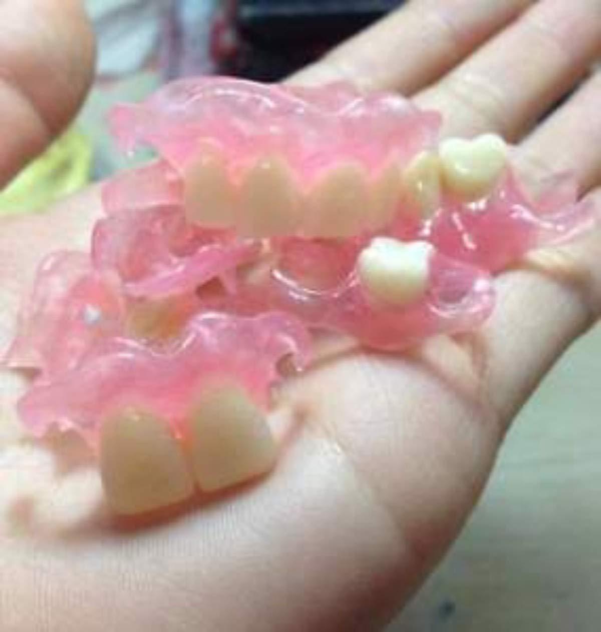 Custom Pink Valplast Partial Denture - Affordable & Flexible | Buy Now ...