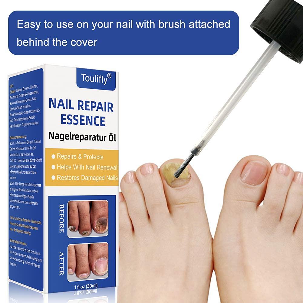 Maximum Strength Nail Repair Solution - Repairs and Protects ...