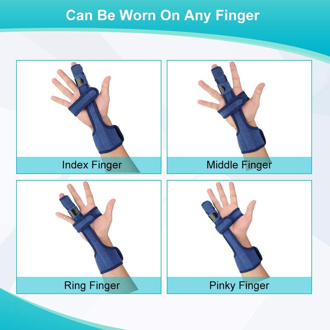 Adjustable Finger Rail Orthosis for Pain Relief | Improve Tenosynovitis ...