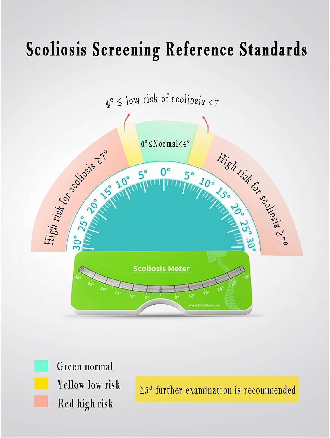 STMKB Electronic Scoliosis Measuring Line | Accurate Spine Evaluation ...