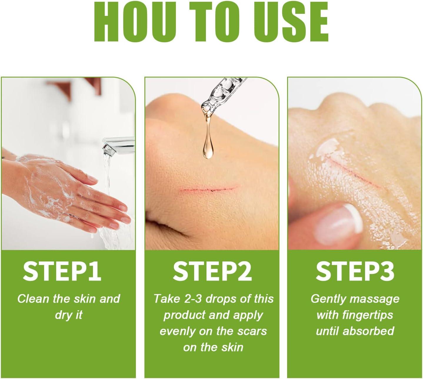 Medical Grade Advanced Scar Repair Serum - Nature Scar Treatment for ...