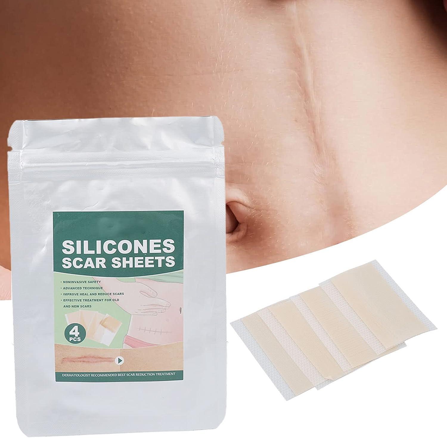 Professional Silicone Scar Removal Sheets - Reusable Gel Strips for ...