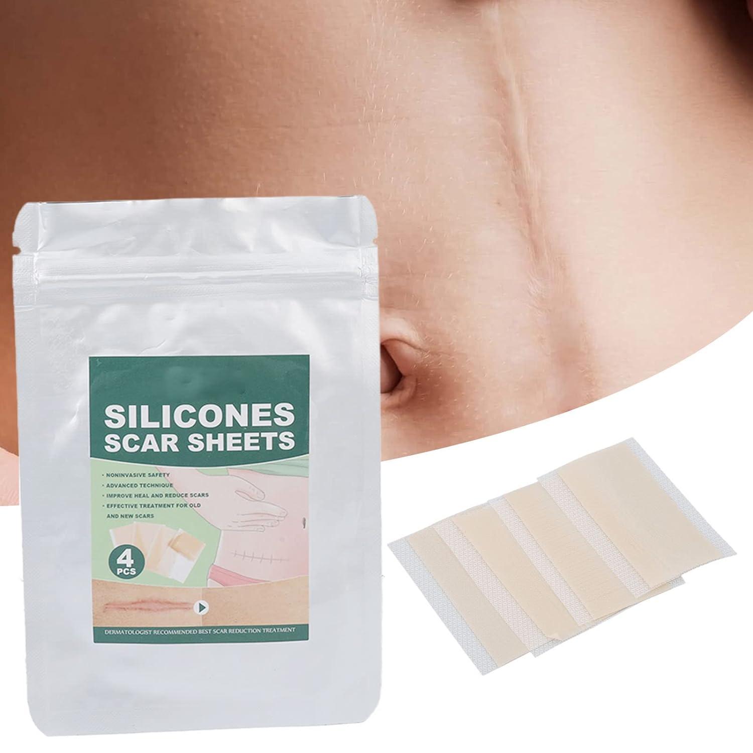 Silicone Scar Cover Up Tape for Stretch Marks - Professional Gel Sheets ...