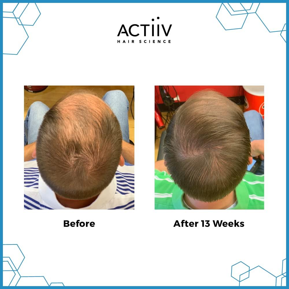 ACTIIV Recover Thickening Hair Loss Shampoo Treatment for Men - 6 Fl Oz ...