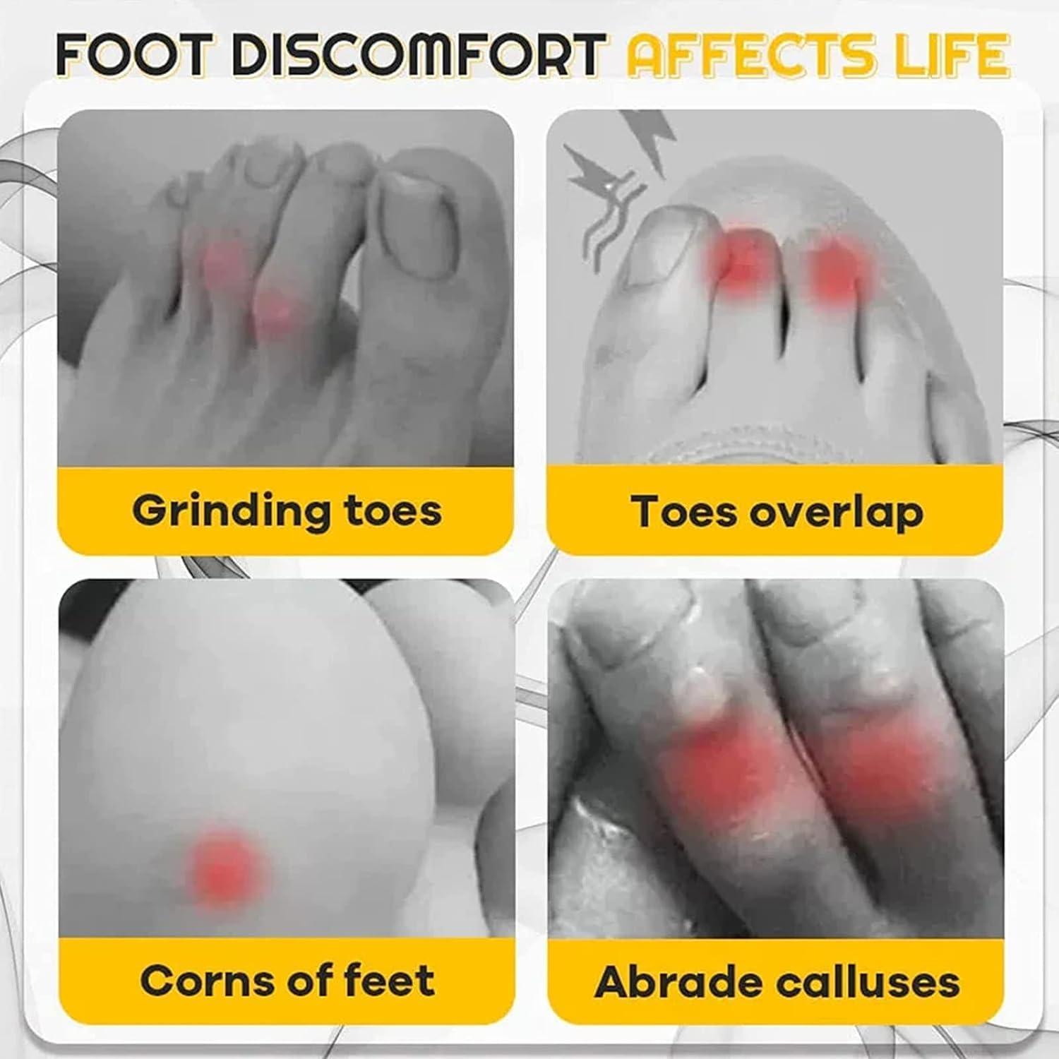 2023 Silicone Anti-Friction Toe Protectors - Breathable Covers for Toe ...