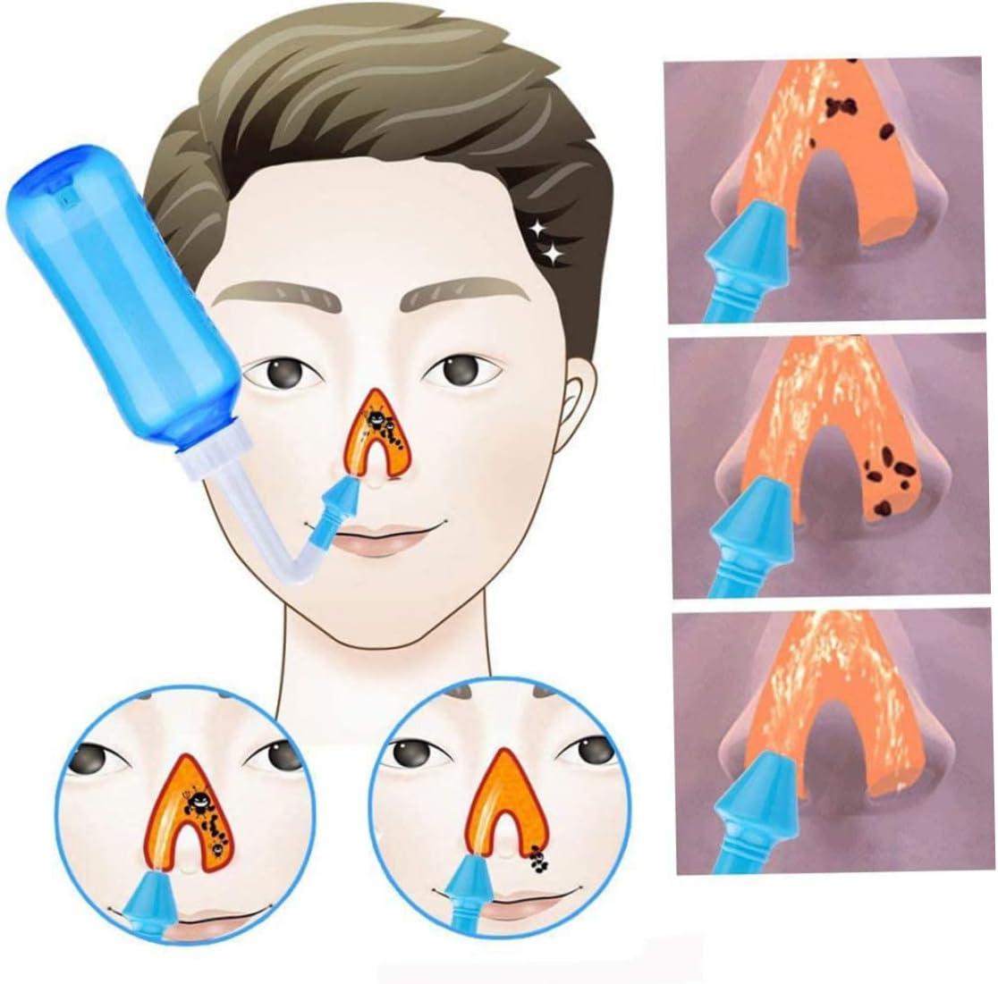 Sinus Rinse Bottle - Pressure Nasal Irrigation for Adults & Kids ...