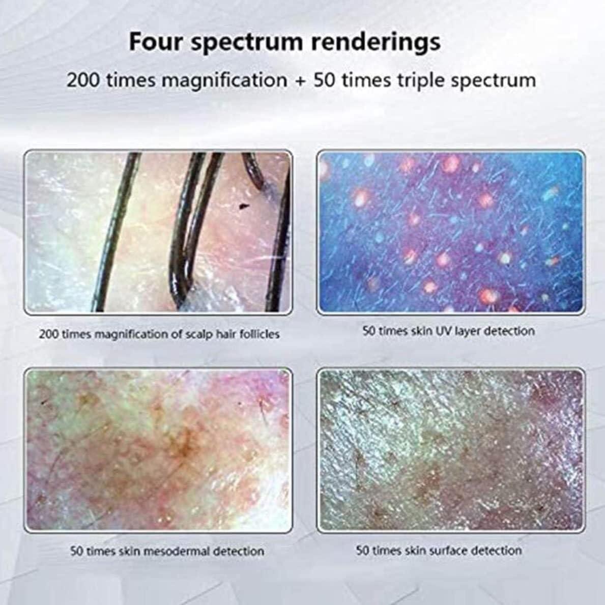 SDTOOP Scalp Detector with Four Images Comparison Facial Skin Oil ...