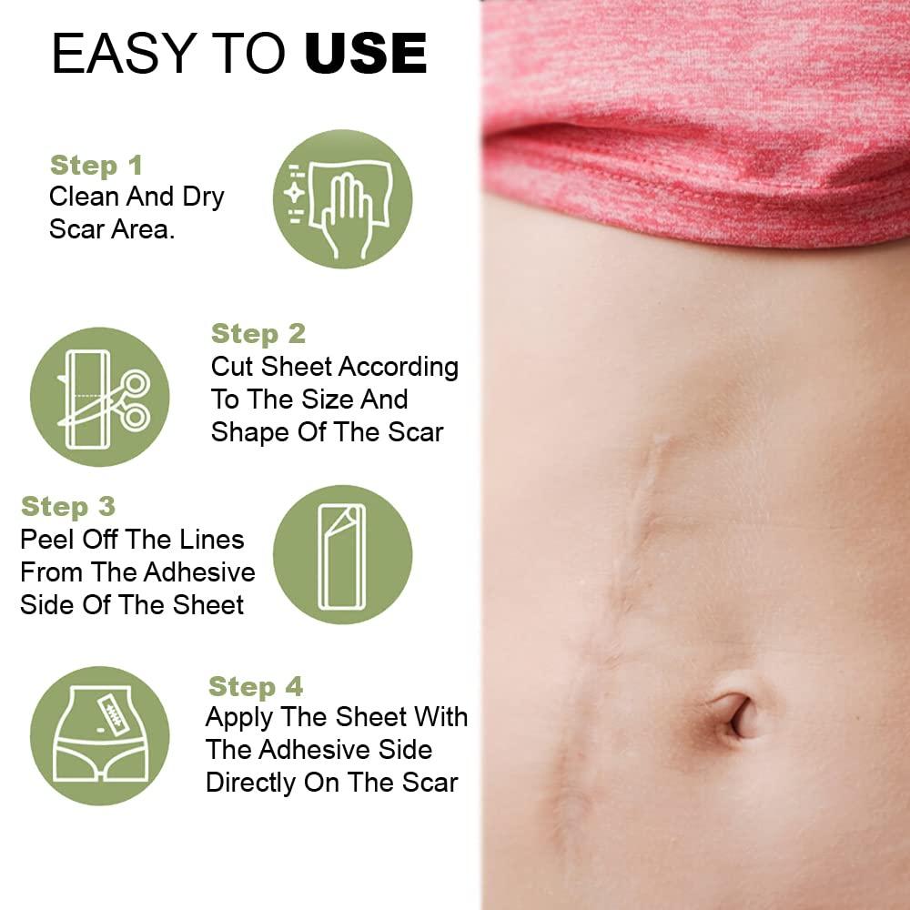 Medical Grade Silicone Scar Sheets Roll - Soft Easy-Tear & Reusable ...