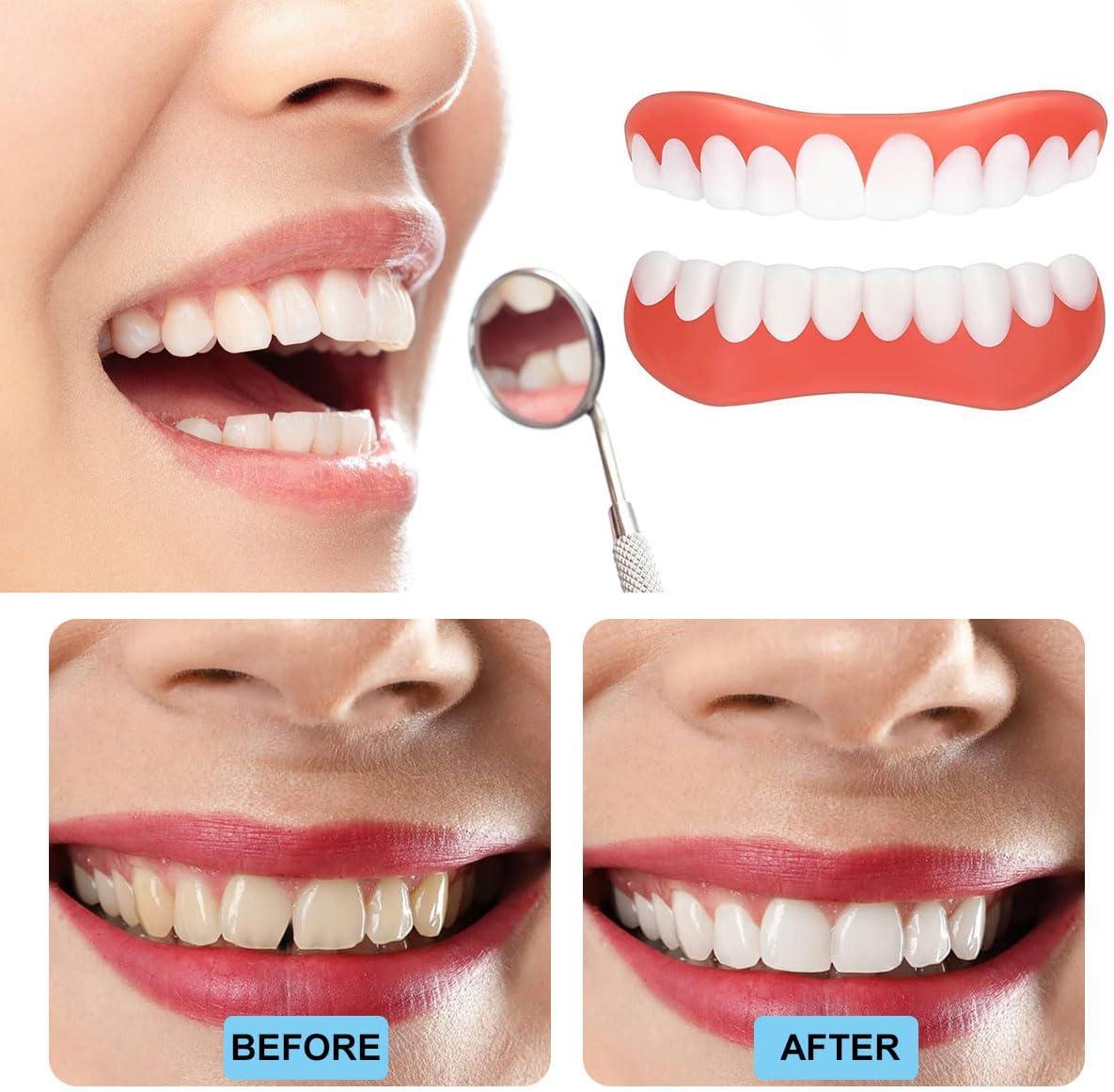 Buy High-Quality False Teeth Veneers | Cosmetic Tooth Covers ...