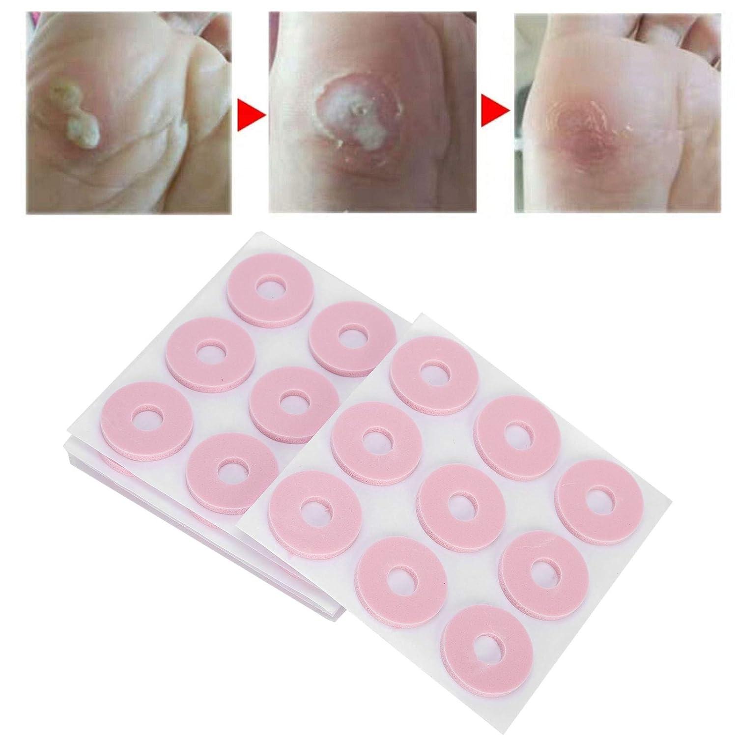 Round Pink S Callus Cushions - Soft Breathable Foot Protectors for ...
