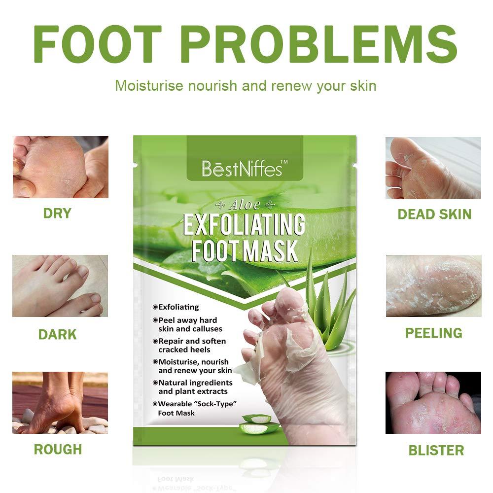 Foot Peel Mask (5 Pack) - Natural Exfoliating Foot Masks for Dry Skin ...