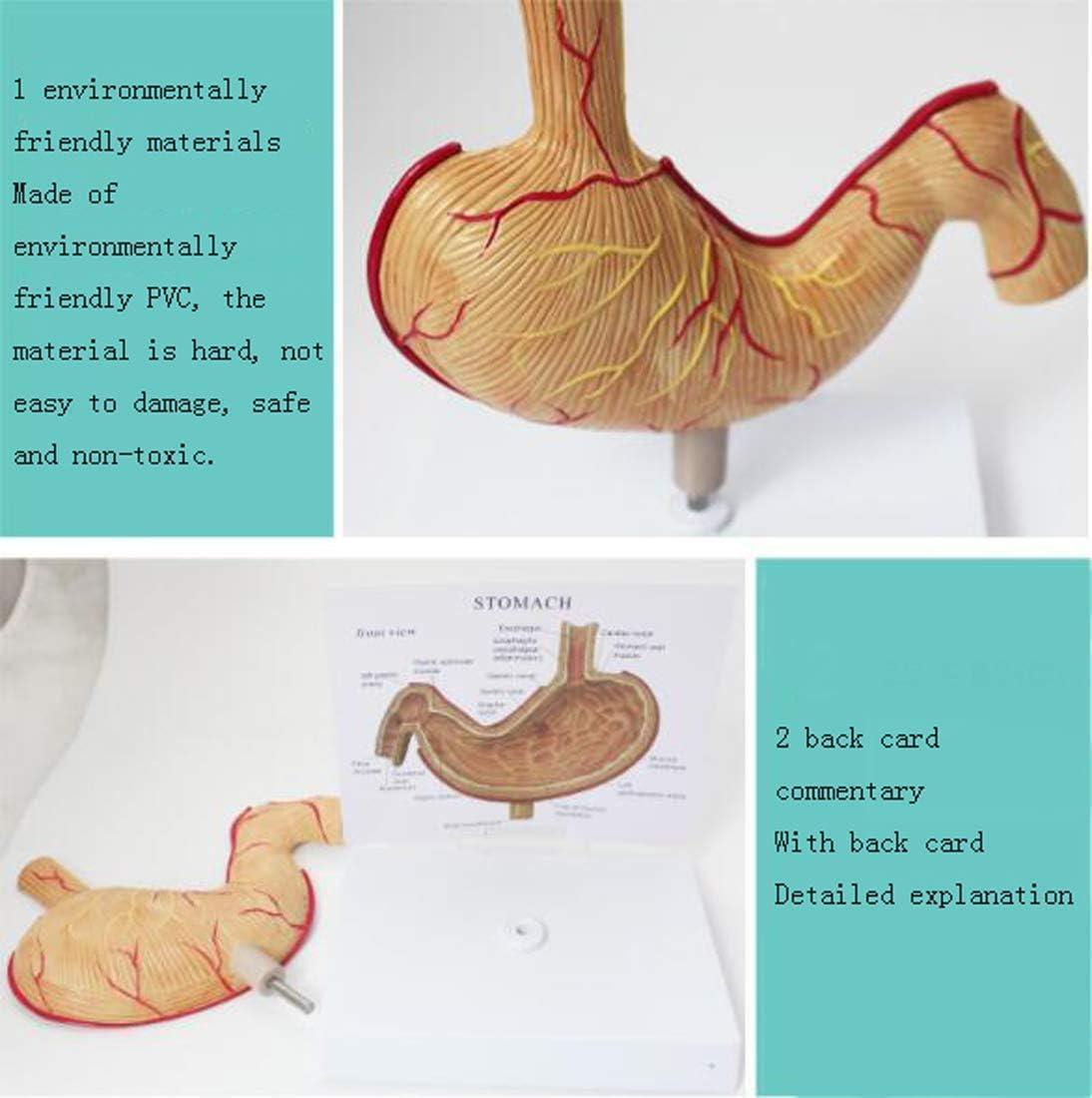 Educational Model Simulated Human Stomach Anatomy Model Diseased ...