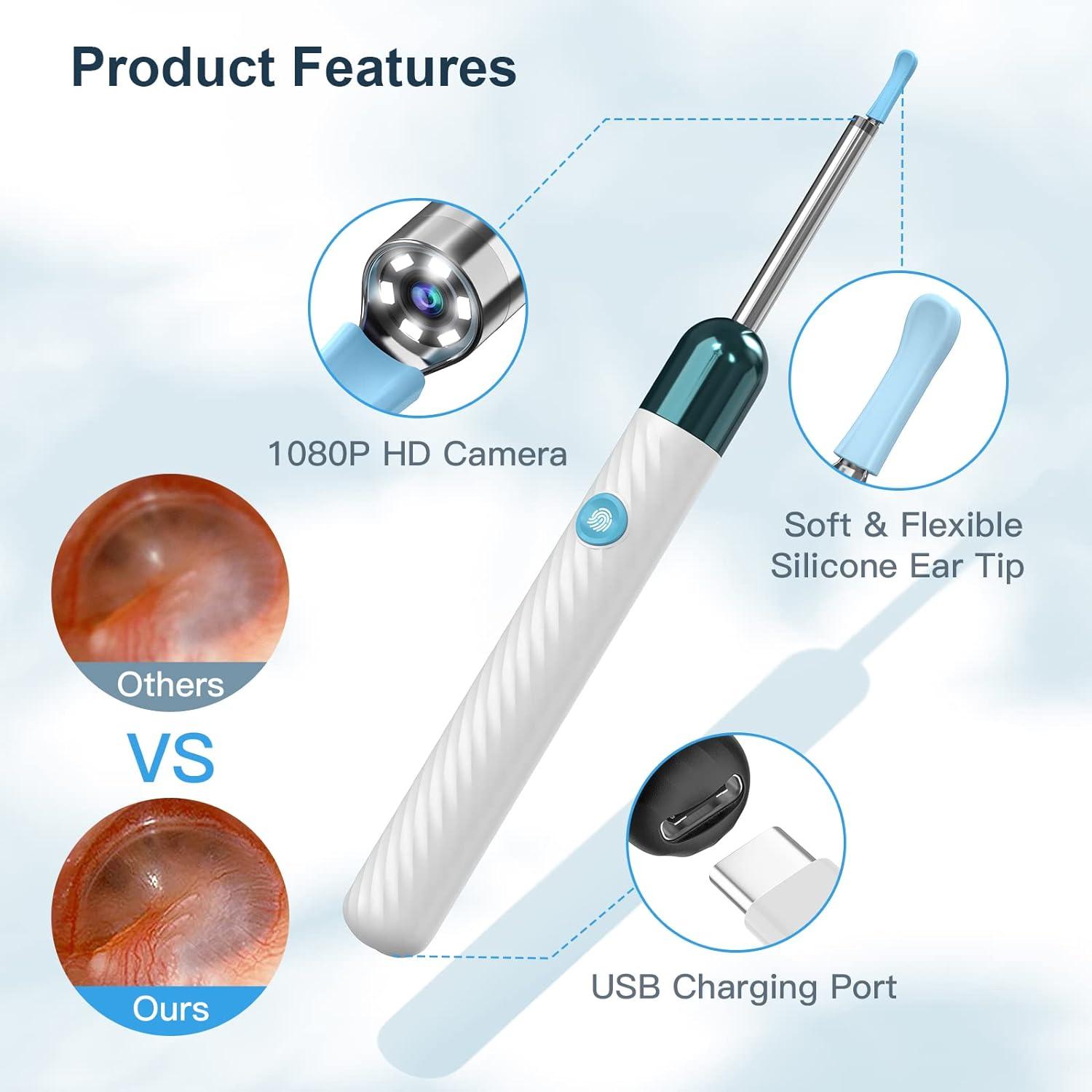 1080P Wireless Ear Wax Removal Kit with Camera | Visual Otoscope for ...