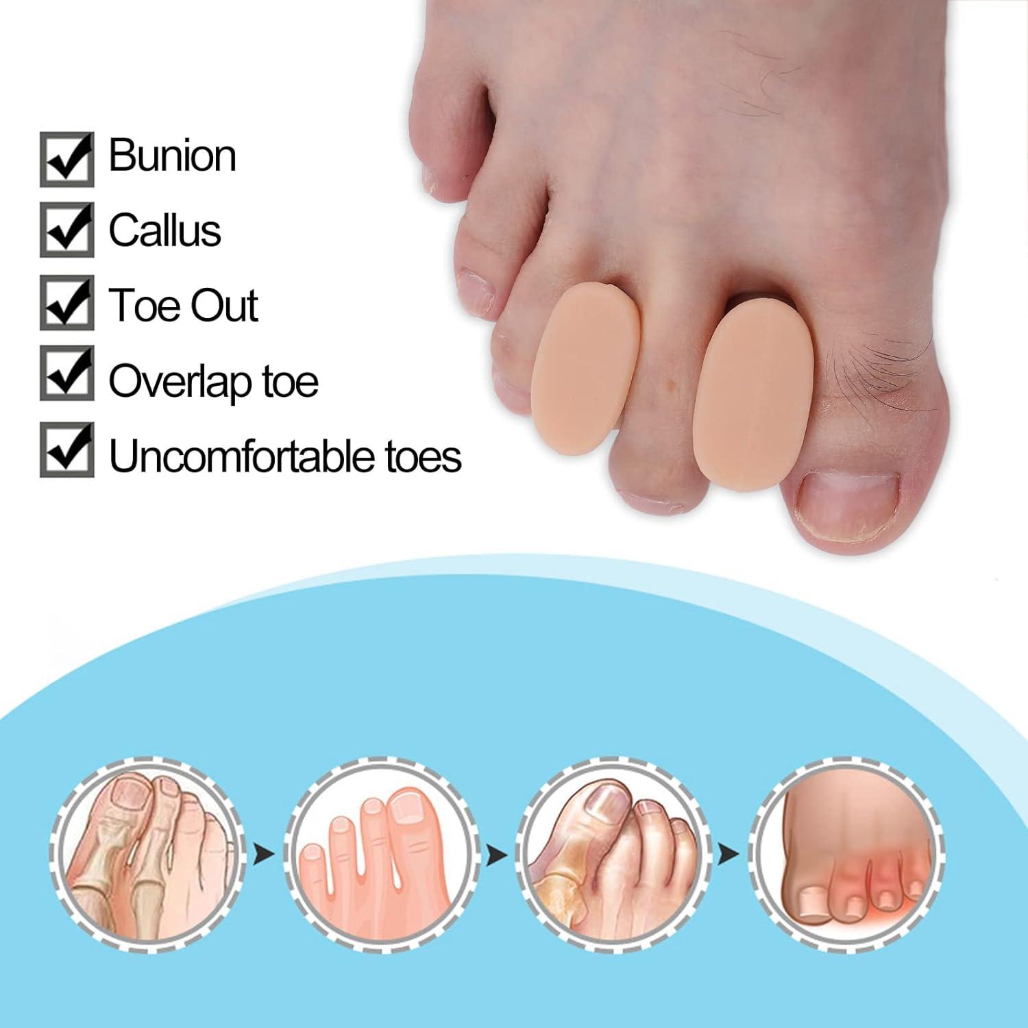 Silicone Toe Spacers 8 Pairs - Reduce Friction, Correct Toes, Relieve ...