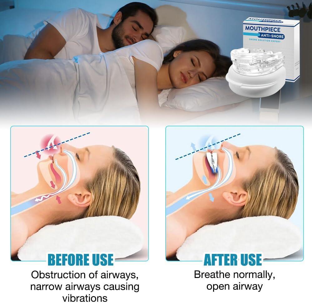 XPJBKC Adjustable Anti-Snoring Rails - 2pcs Snoring Stopper for Men ...