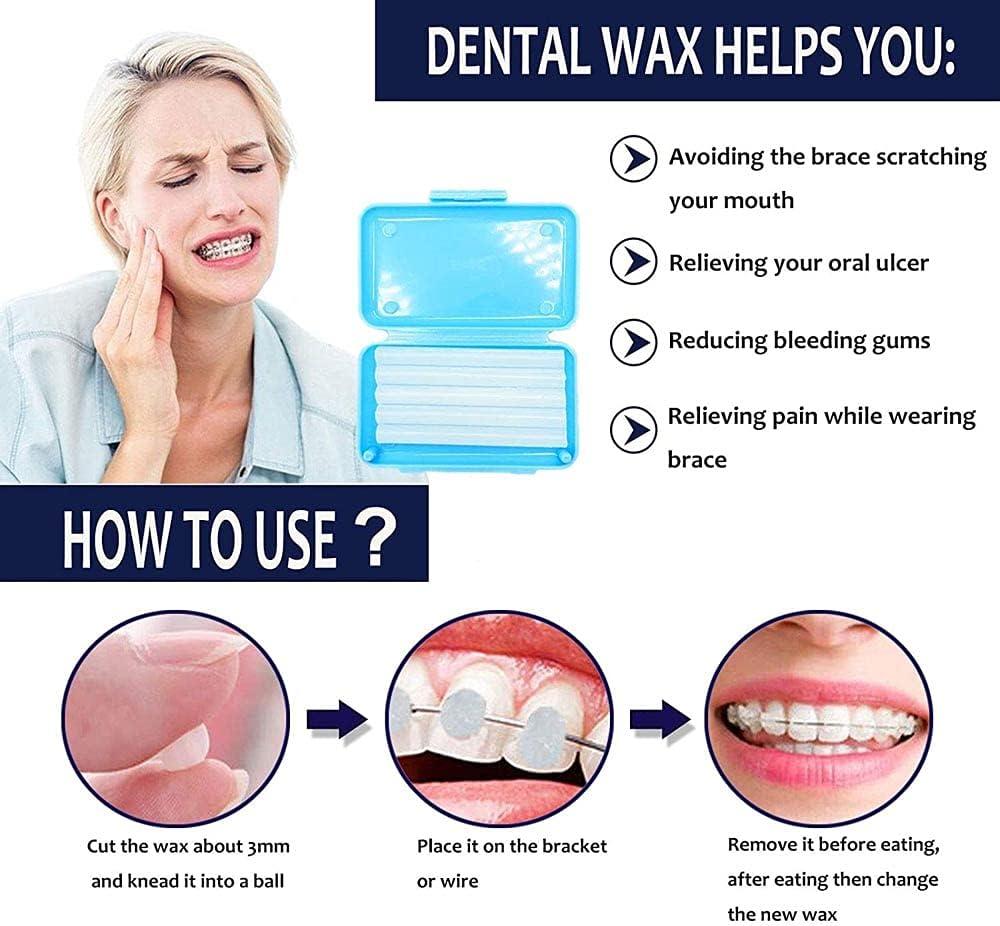 Dental Wax for Braces - Mint Orthodontic Wax (1 Box, 50 Uses) | Buy Now ...