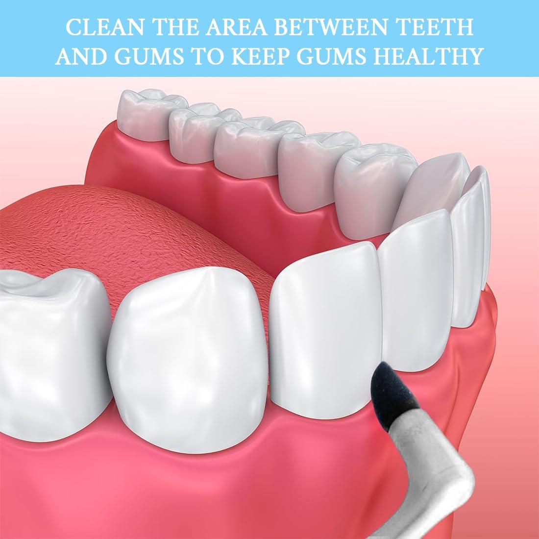 KSJEHW 4-Piece Tartar Remover Set | Professional Tooth & Denture ...