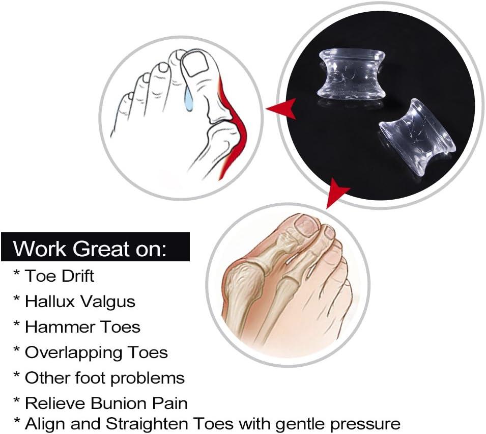 Buy Sumiwish 10x Gel Hallux Toe Spreader - Pain Relief & Correction for ...