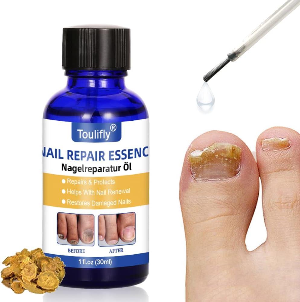 Nail Fungal Treatment - Extra Strength Cure for Toenail Fungus | Buy ...