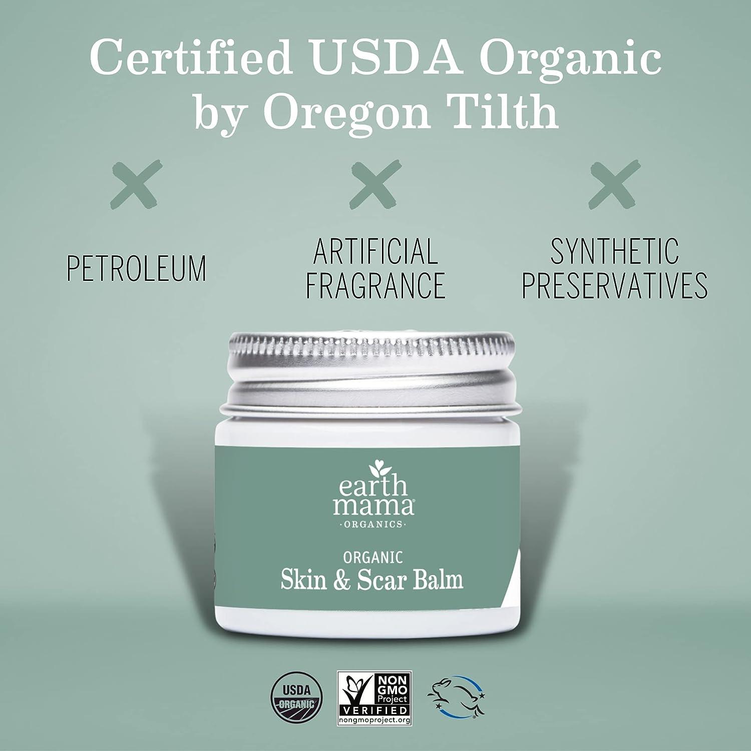 Earth Mama Organic Skin & Scar Balm - 1 Fl Oz (Pack of 1) | Reduces ...