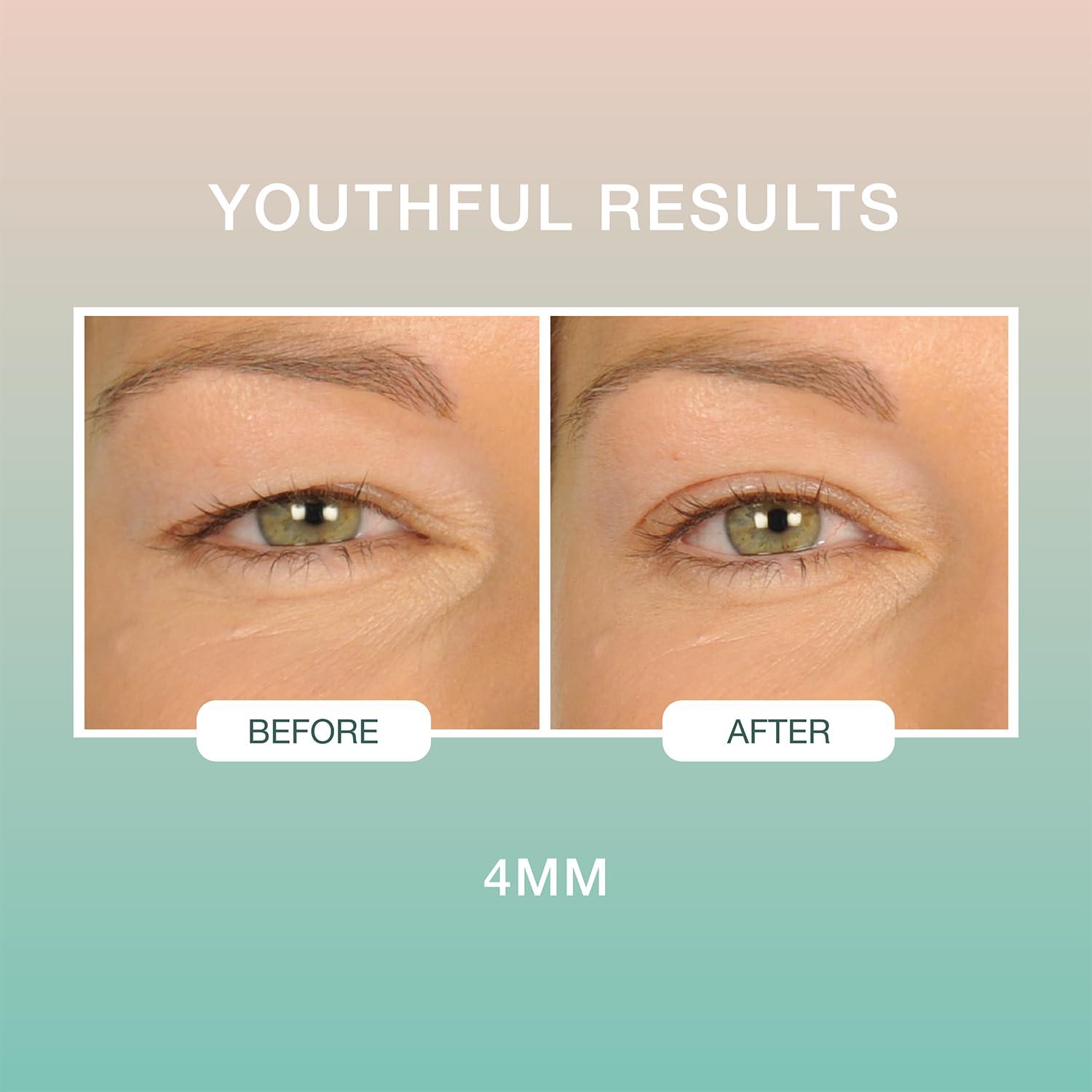Eyelid Correcting Strips for Heavy Hooded Lids - LIDS BY DESIGN, 80 ...