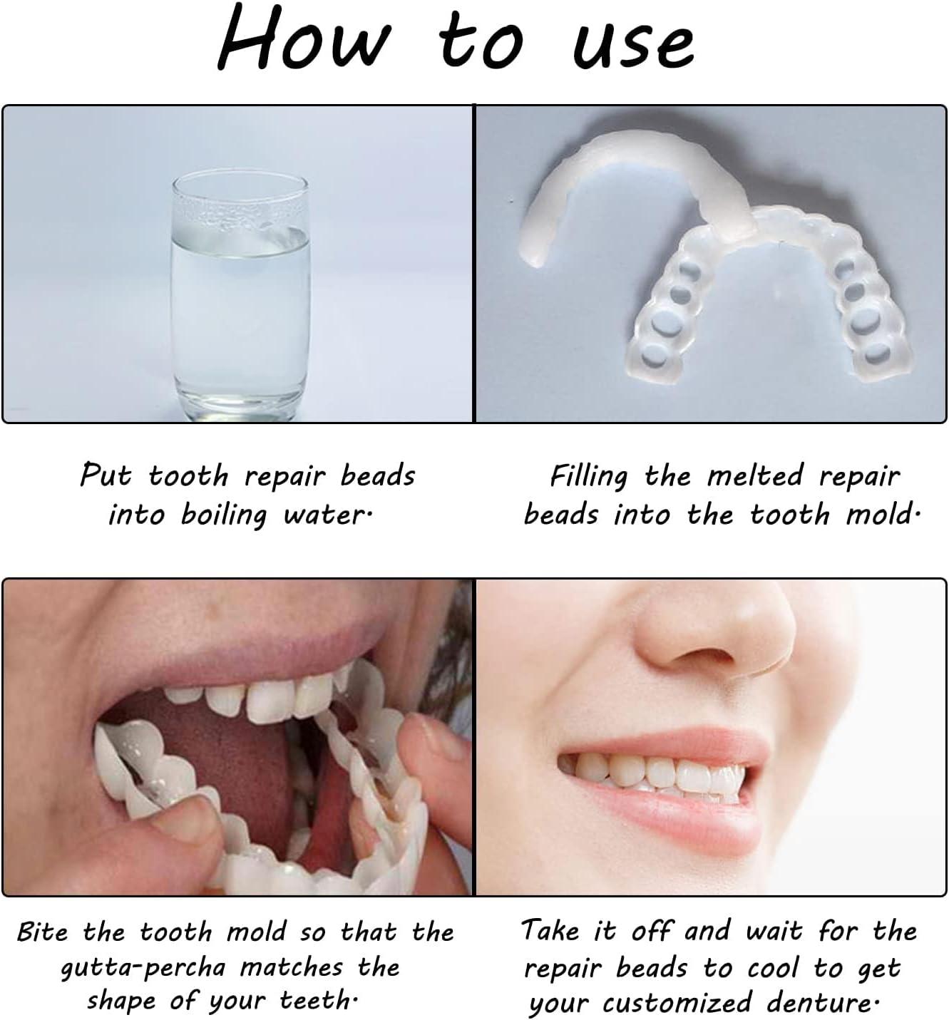 Flipped Warm Veneers - Cosmetic Lightening Teeth Set | Top & Bottom ...