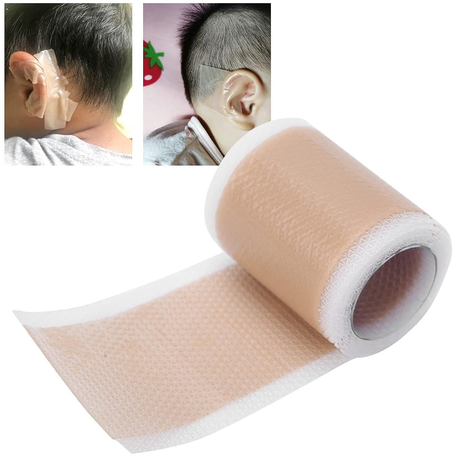 Silicone Kids Infant Ear Patch Stickers - Ear Aesthetic Correctors (4cm ...