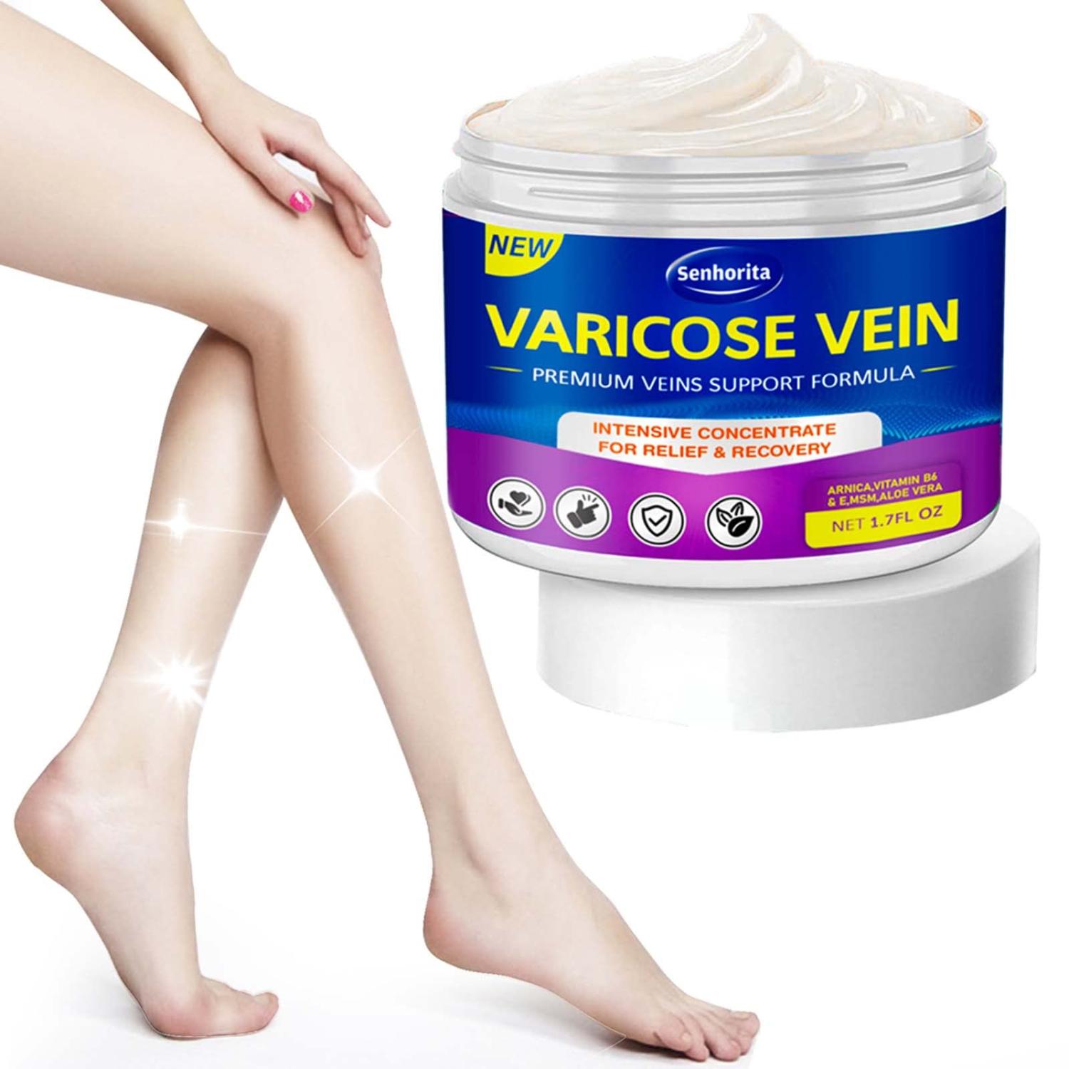 Varicose Veins Cream - Effective Treatment for Legs | Strengthen ...