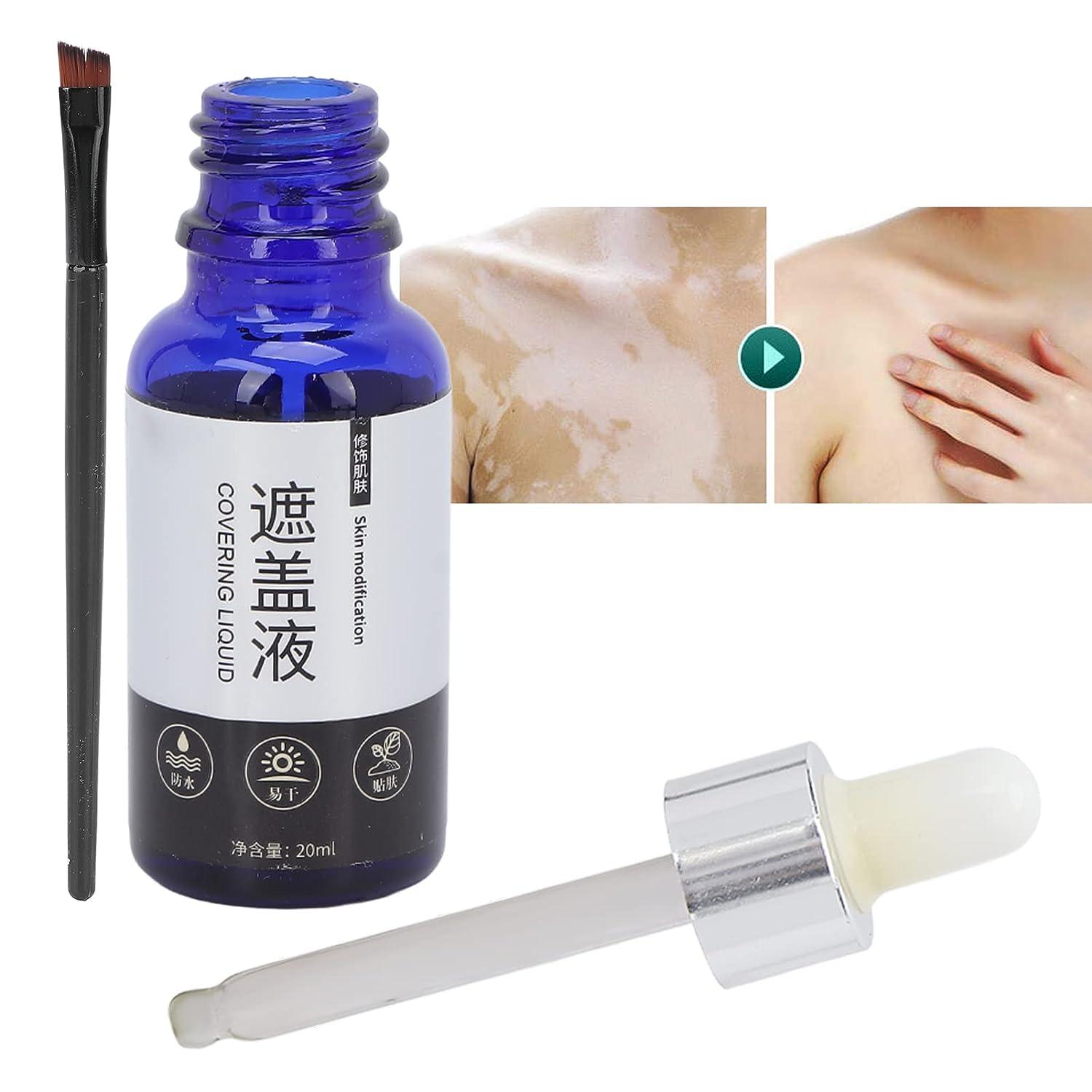Vitiligo Cover Liquid - Body Makeup for Legs - Men and Women | Buy Now ...