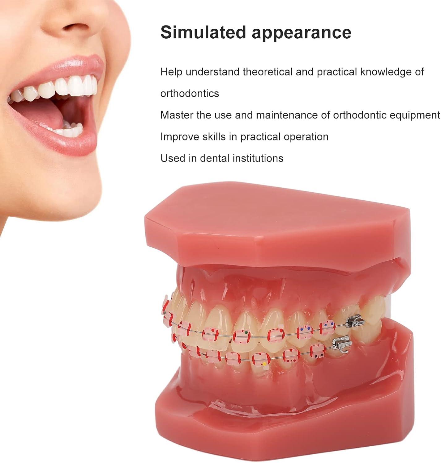 Orthodontic Bracket Model - Educational Demonstration with Metal Wires ...