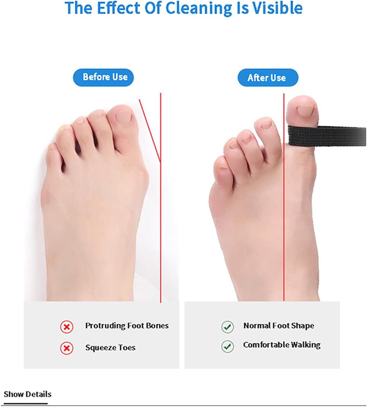 Infit Big Toe Exerciser Orthotic Device for Hallux Valgus Tension Band ...