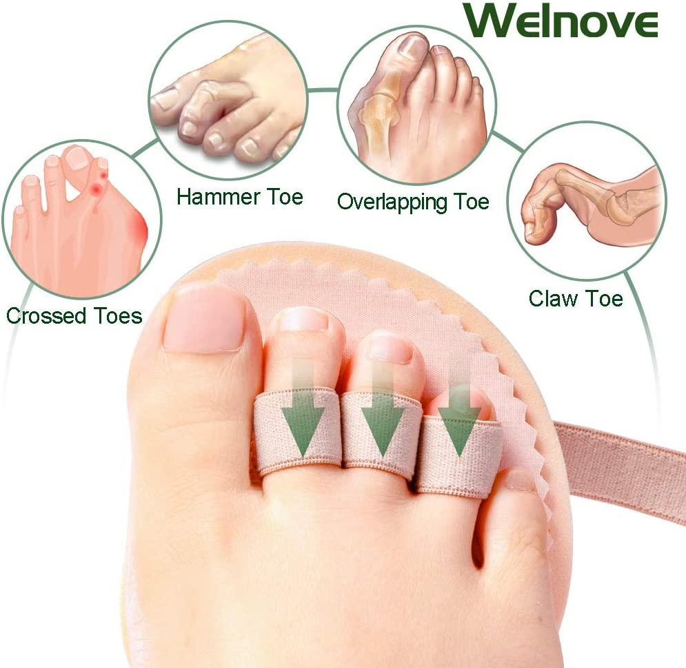 Welnove Toe Straightener Hammer Toe Corrector Pack Of 2 3 Hole Splint