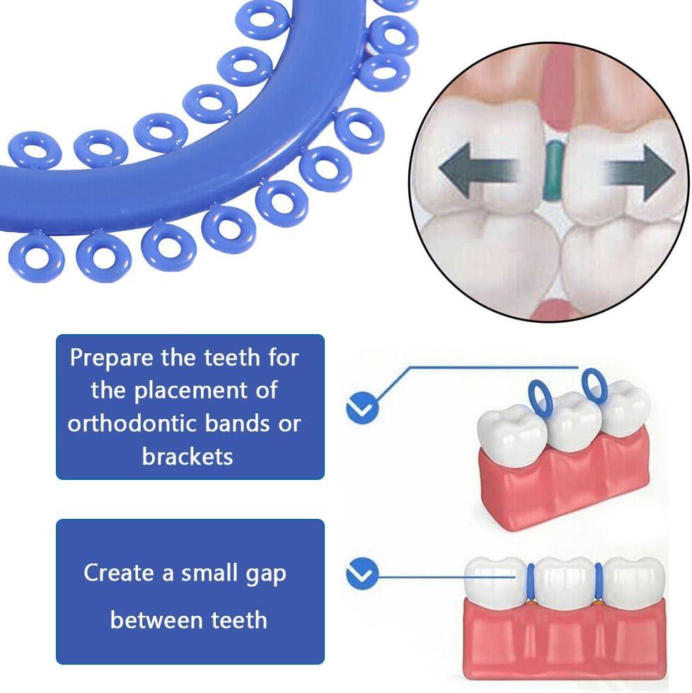 Braces Separator - 700 PCS Teeth Elastic Orthodontic Ligature Ties ...