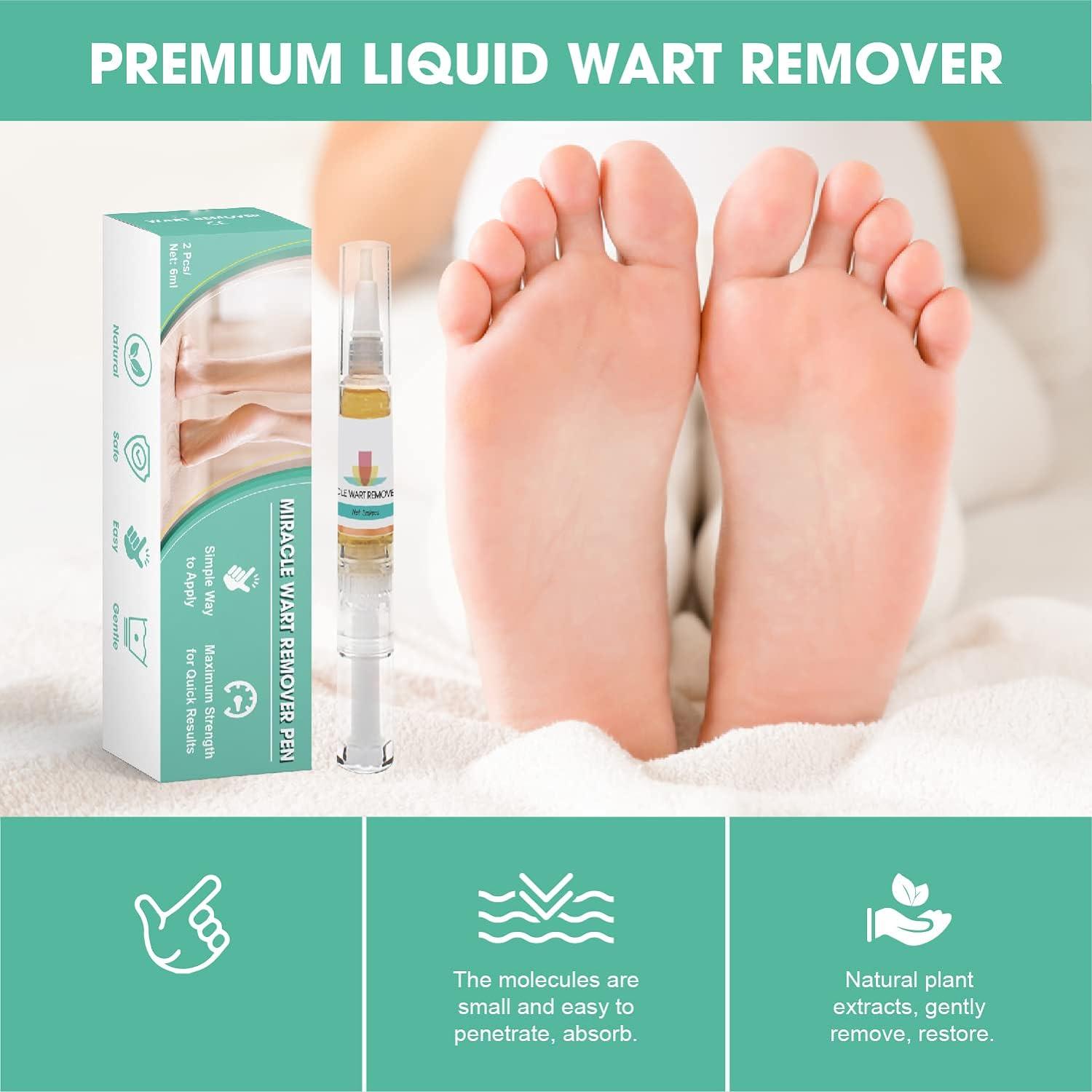 Wart Remover Pens - Natural & Safe Treatment for Foot & Hand Warts ...