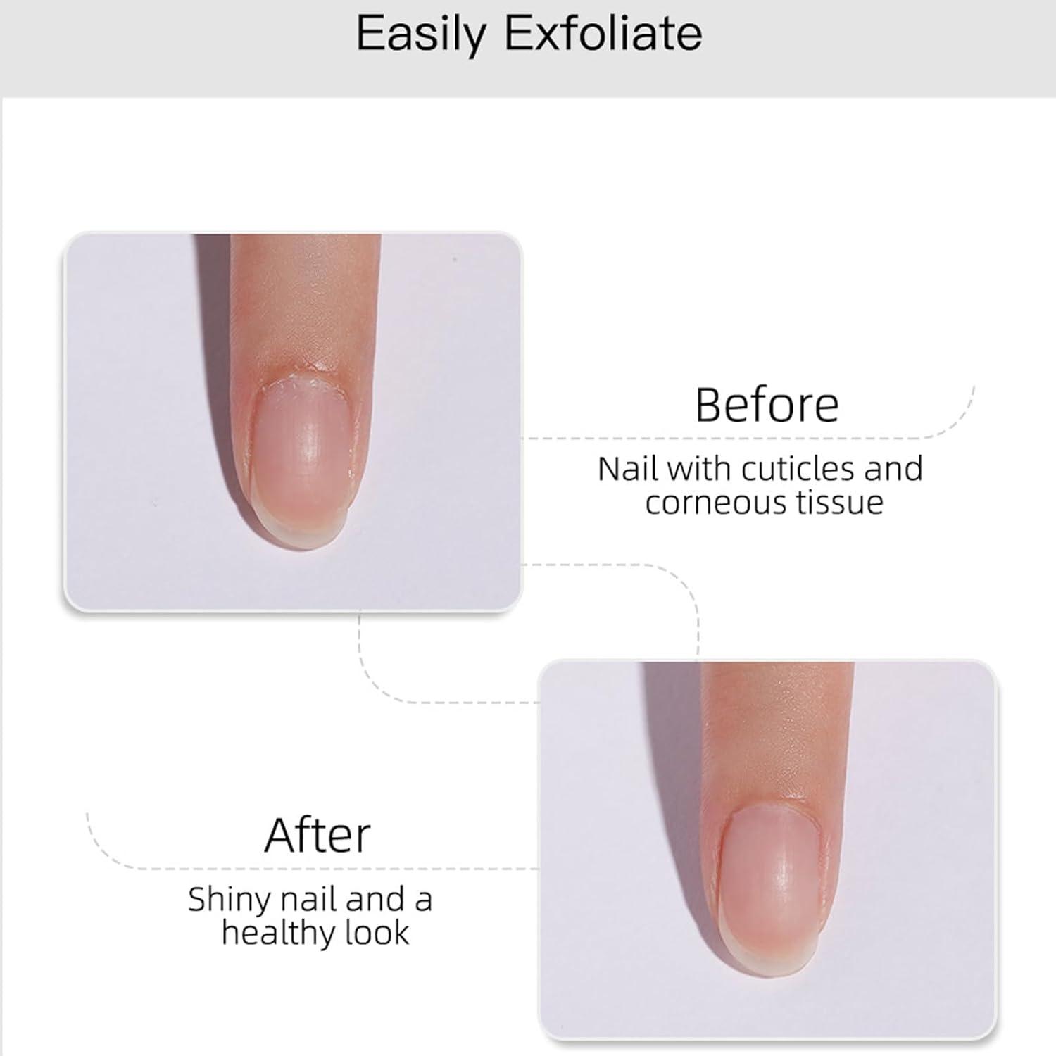Cuticle Remover Gel: Gentle Softener, Moisturizes, Dissolves Dry ...