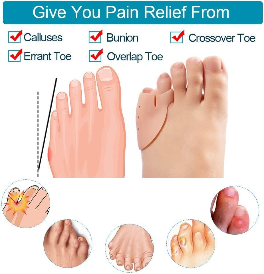Norhogo Silicone Toe Separator - 4 Pairs for Pinky & Overlapping Toes ...
