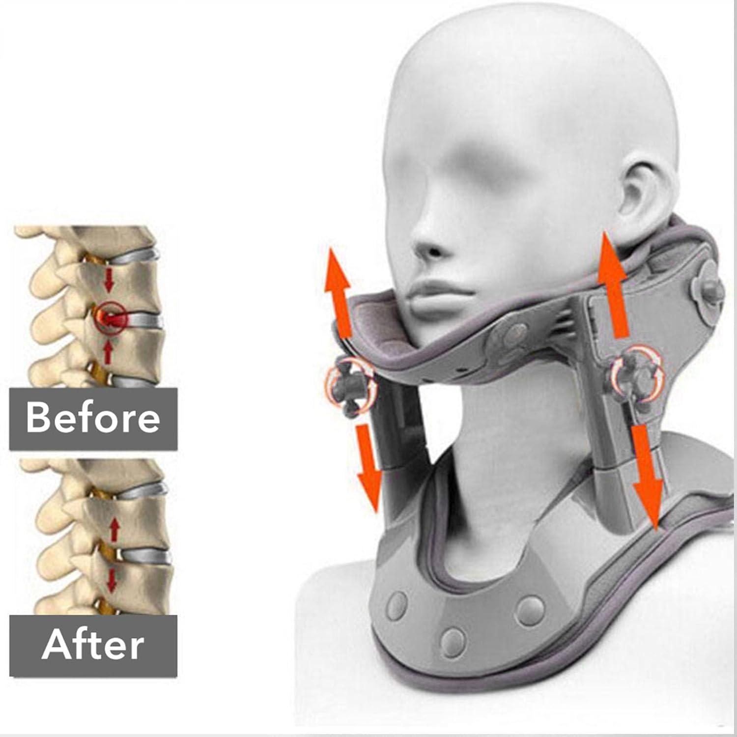 Electric Cervical Neck Traction Device - Hot Compress Neck Stretcher ...