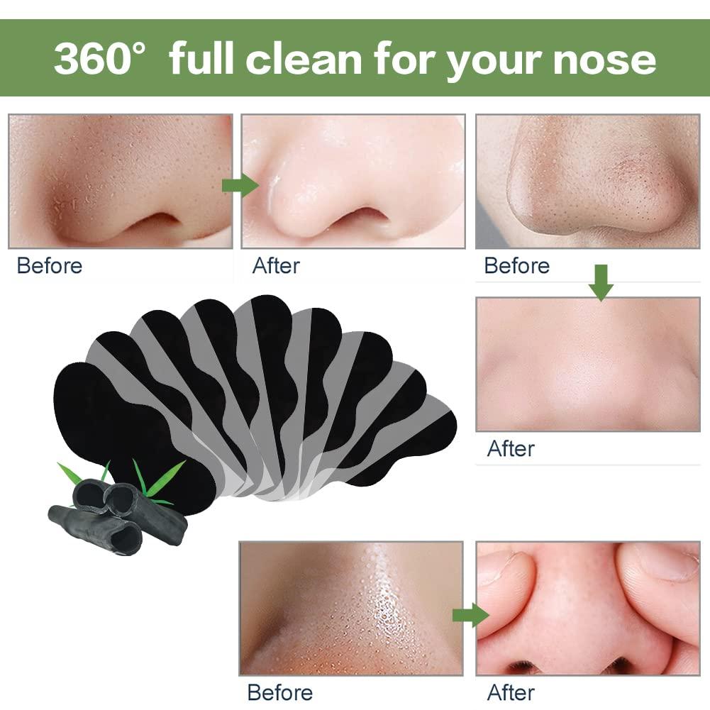 20 Blackhead Nose Strips for Men & Women - Effective Pore Clear-Up ...